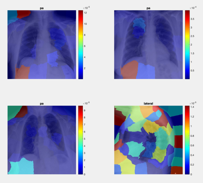 Explainable AI for Medical Images - DataScienceCentral.com Explainable AI for Medical Images - DataScienceCentral.com