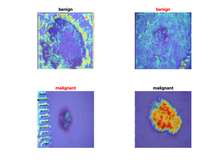 Explainable AI for Medical Images - DataScienceCentral.com Explainable AI for Medical Images - DataScienceCentral.com